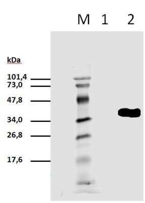 CD3 zeta Antibodies: Novus Biologicals
